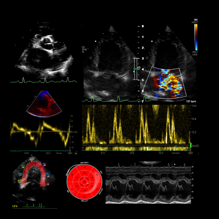 Echocardiography Learning Lab :: TACS-Alliance Research Center